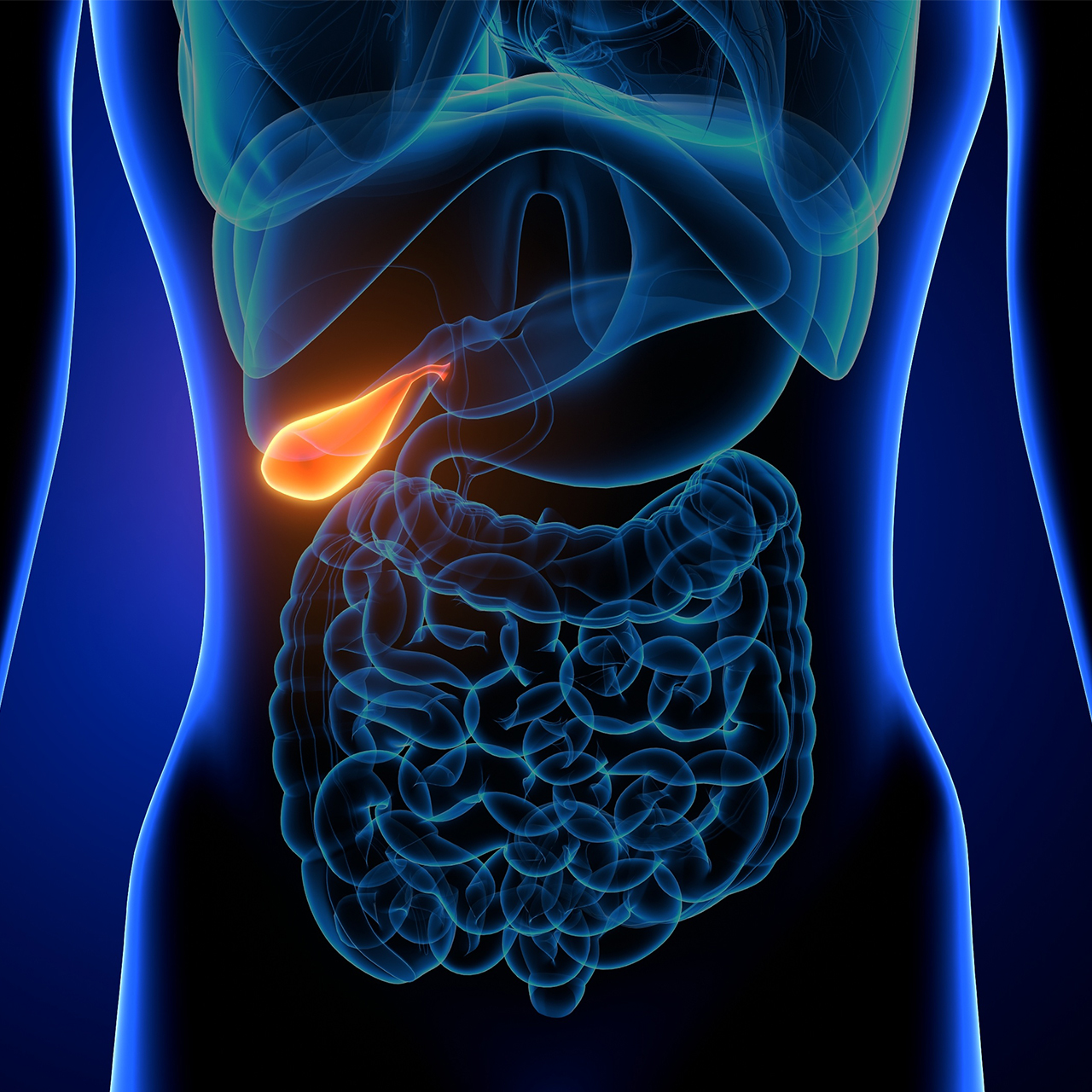 Gallbladder Polyps - Dr Thng Yongxian