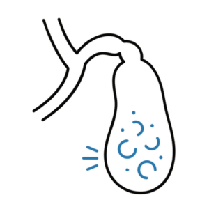 Gallbladder Sludge - Dr Thng Yongxian